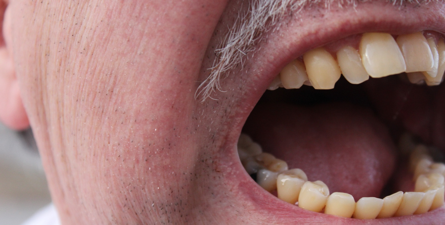 People From Around The World Share Stories Of Adults Having Temper ...